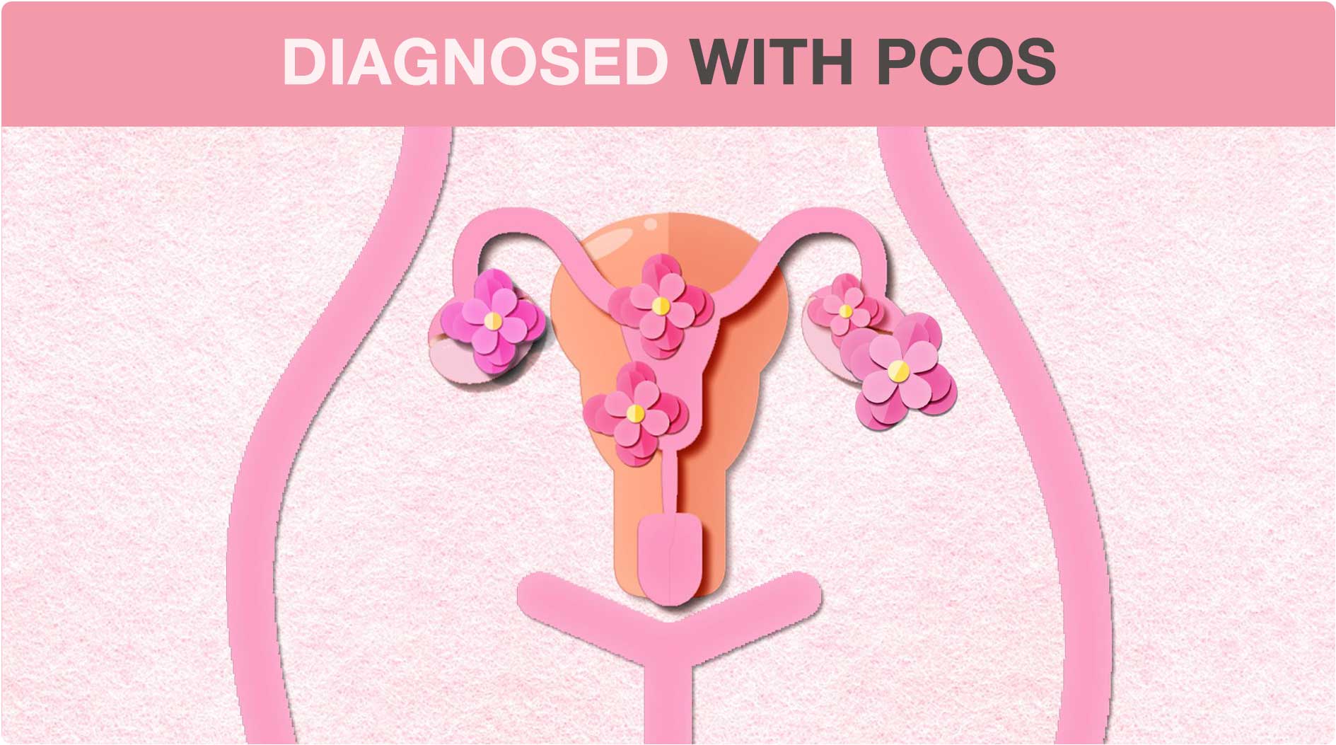 I've Been Diagnosed With PCOS: Now What? – (UK) Health & Balance Vitamins